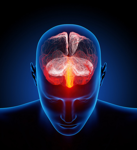 Brain Creative Commons